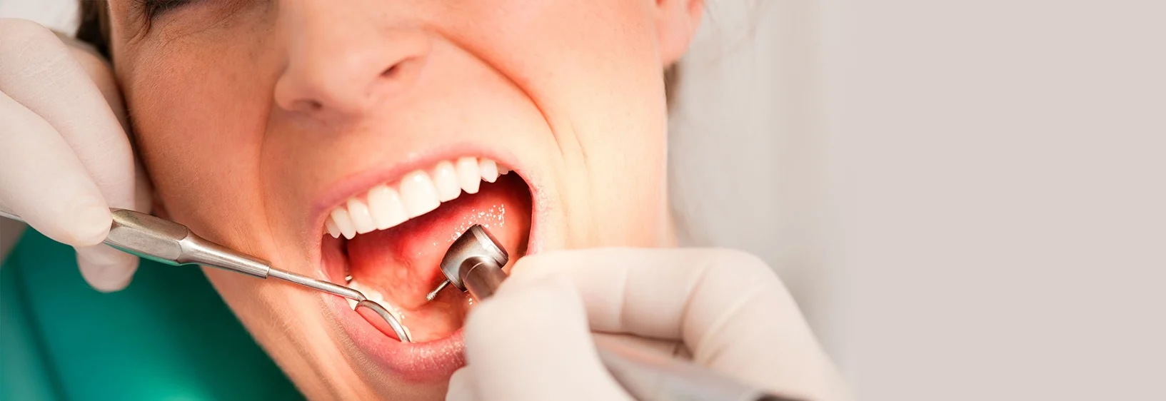 RCT Retreatment - Simple Fix - Schedule An Appointment Today